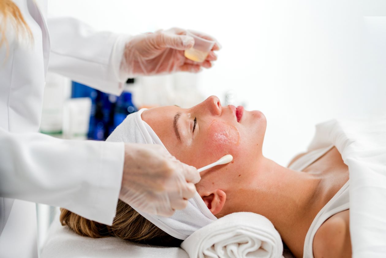 How Often Should I Use a Chemical Peel? - Day Spa | Greeley, CO | Sweet ...